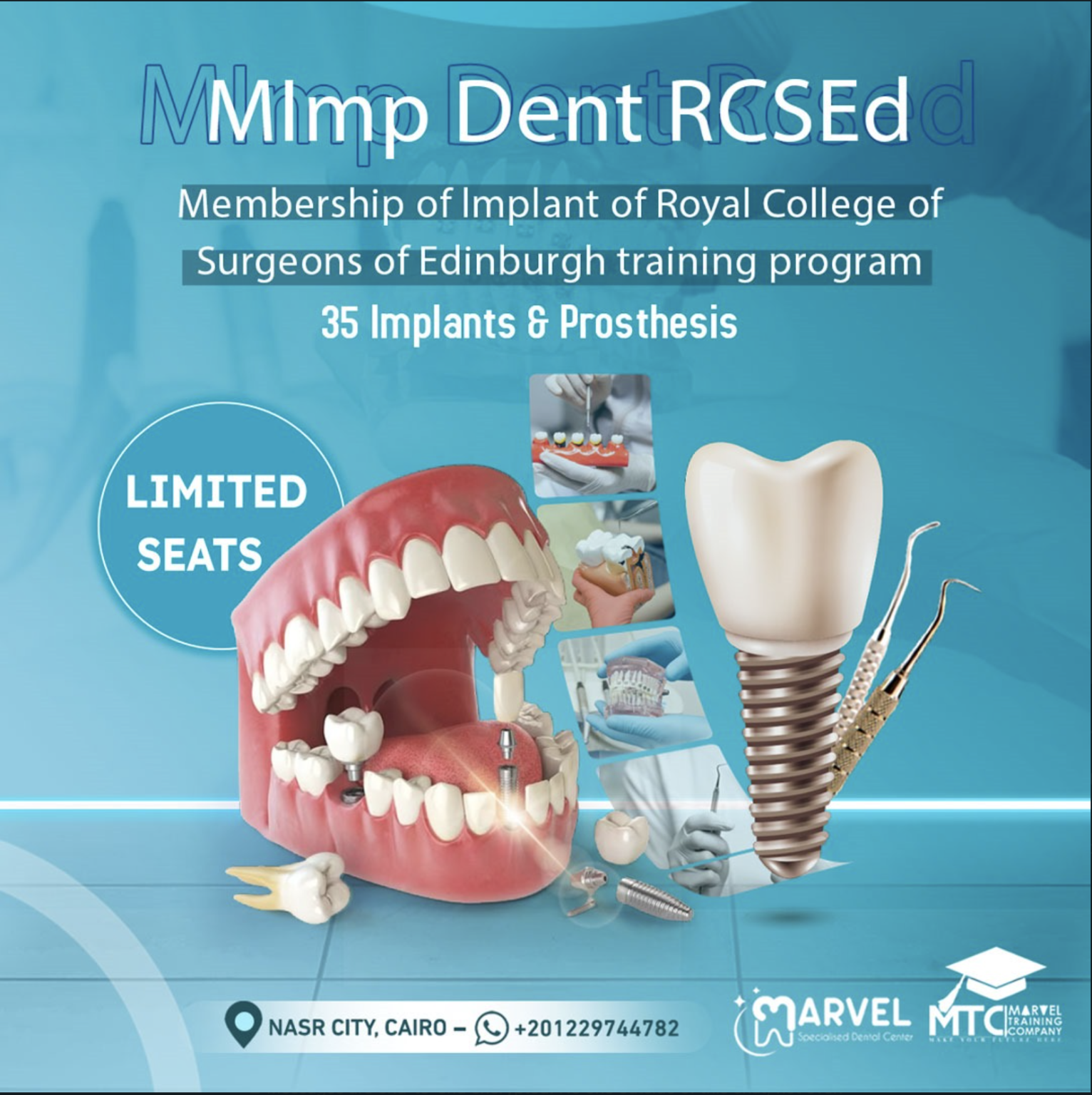 Implantology Residency Program for MImp dent RCSEd – Marvel Training ...
